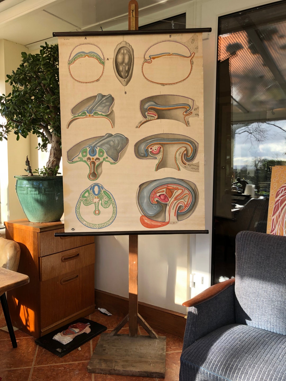 Vintage School Chart EMBRYOLOGY Midwifery Poster ANATOMY Educational ...