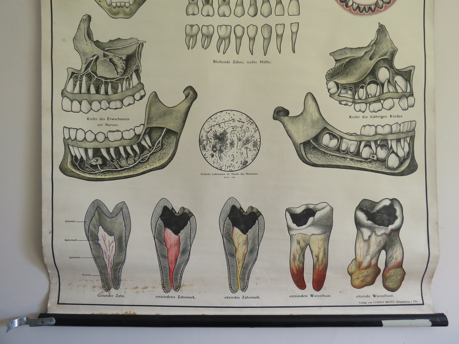 Rare Vintage Medical School Educational Chart of TEETH in HEALTH ...