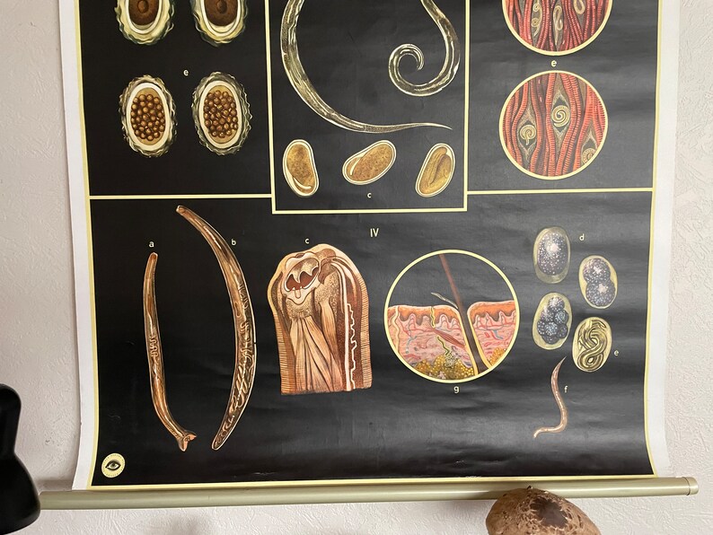 Vintage GUT PARASITES Roll Down Educational School Chart Wall Chart ...