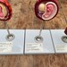 3 Vintage SOMSO Models of EMBRYO DEVELOPMENT in Pregnancy Educational ...