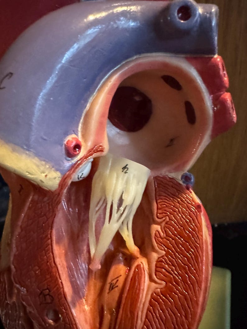 Vintage Somso Human Heart Anatomy Model: Educational Medical Display ...