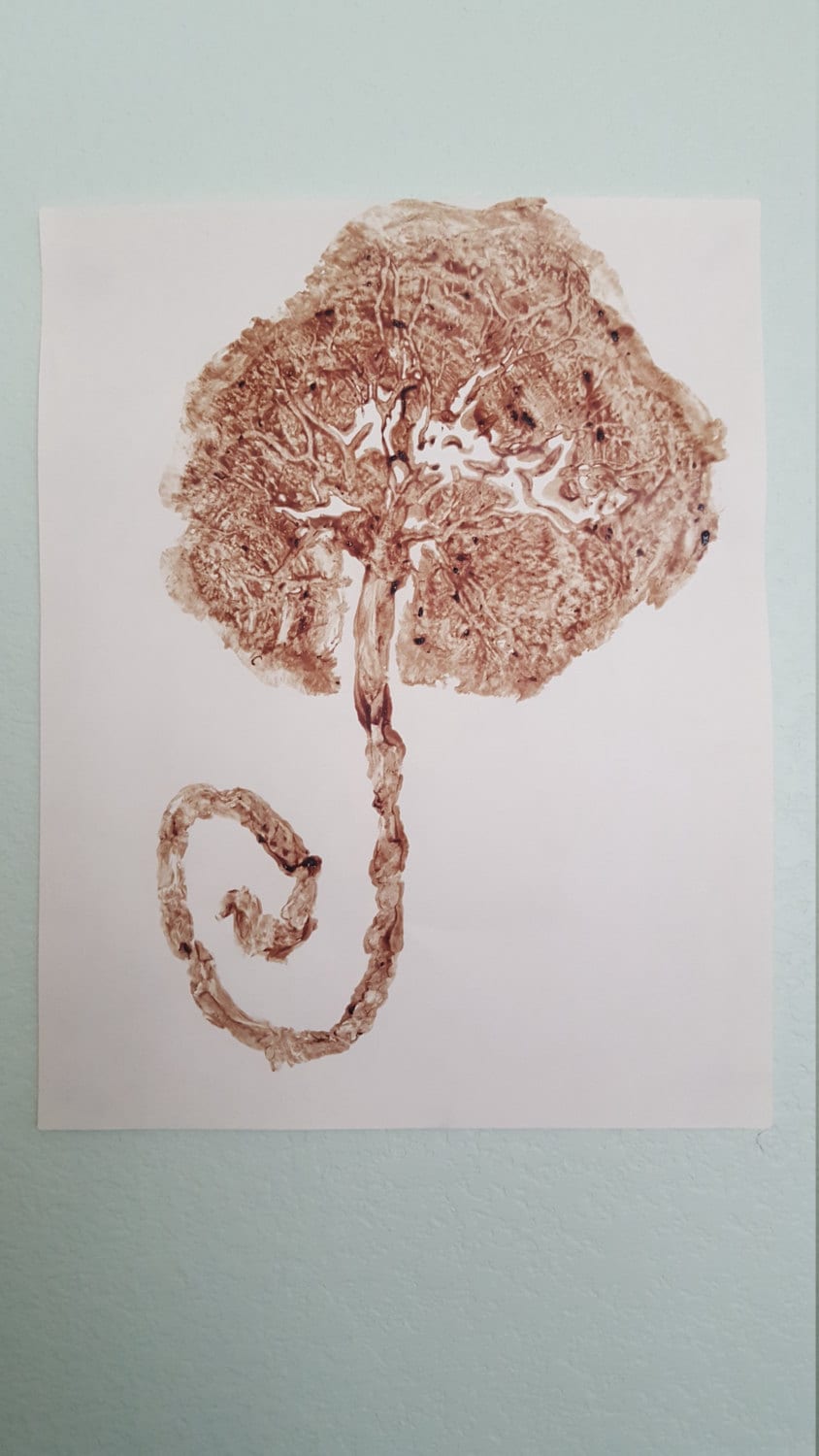 Custom Placenta Print Inspired Painting - Made to Order - Birth Art ...