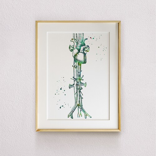 Aorta Angiogram Print Medical Poster Science Art Abdominal | Etsy