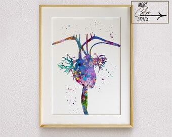 Aorta Anatomy Poster - Etsy
