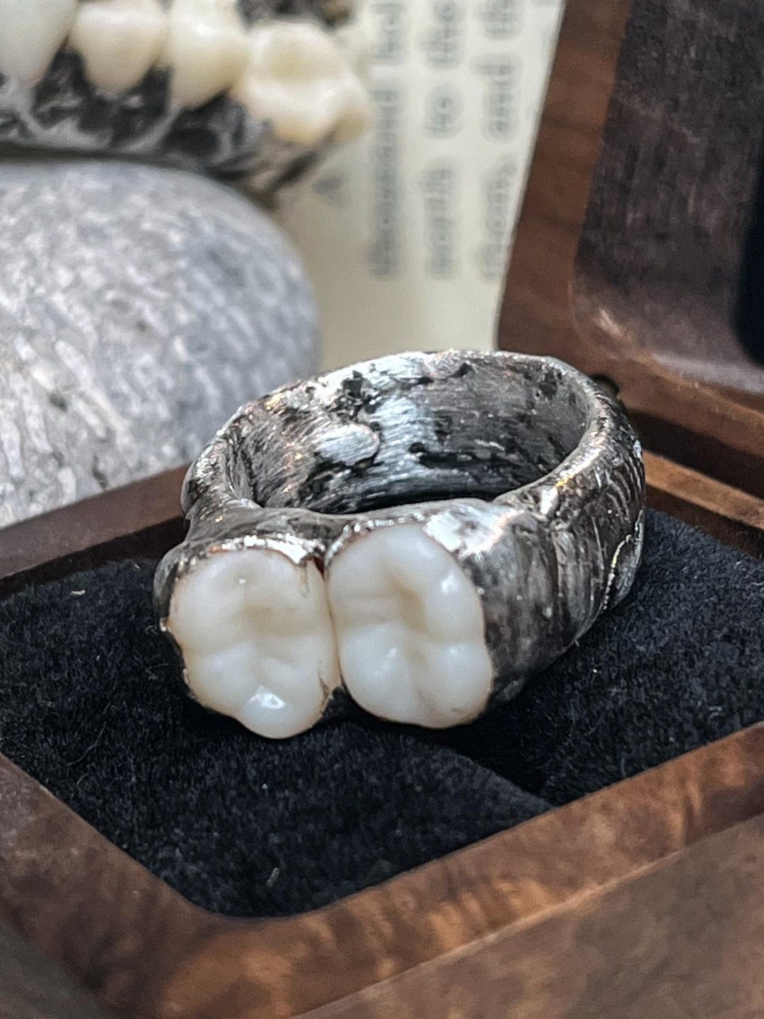 Made to Order Statement Soldered Replica Human Teeth Tooth Dentistry ...