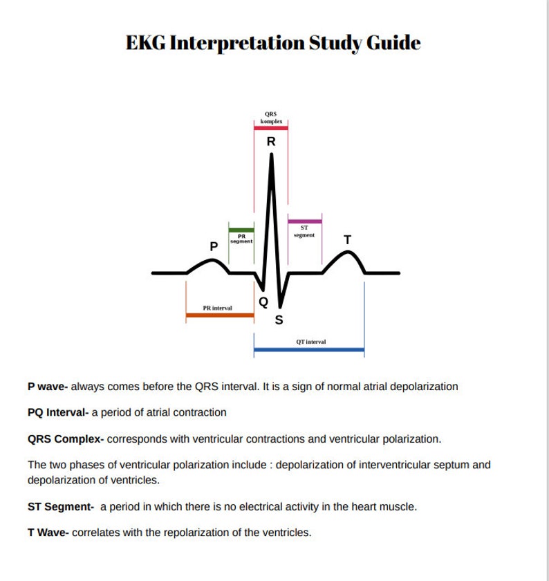 EKG Interpretation Study Guide - Etsy