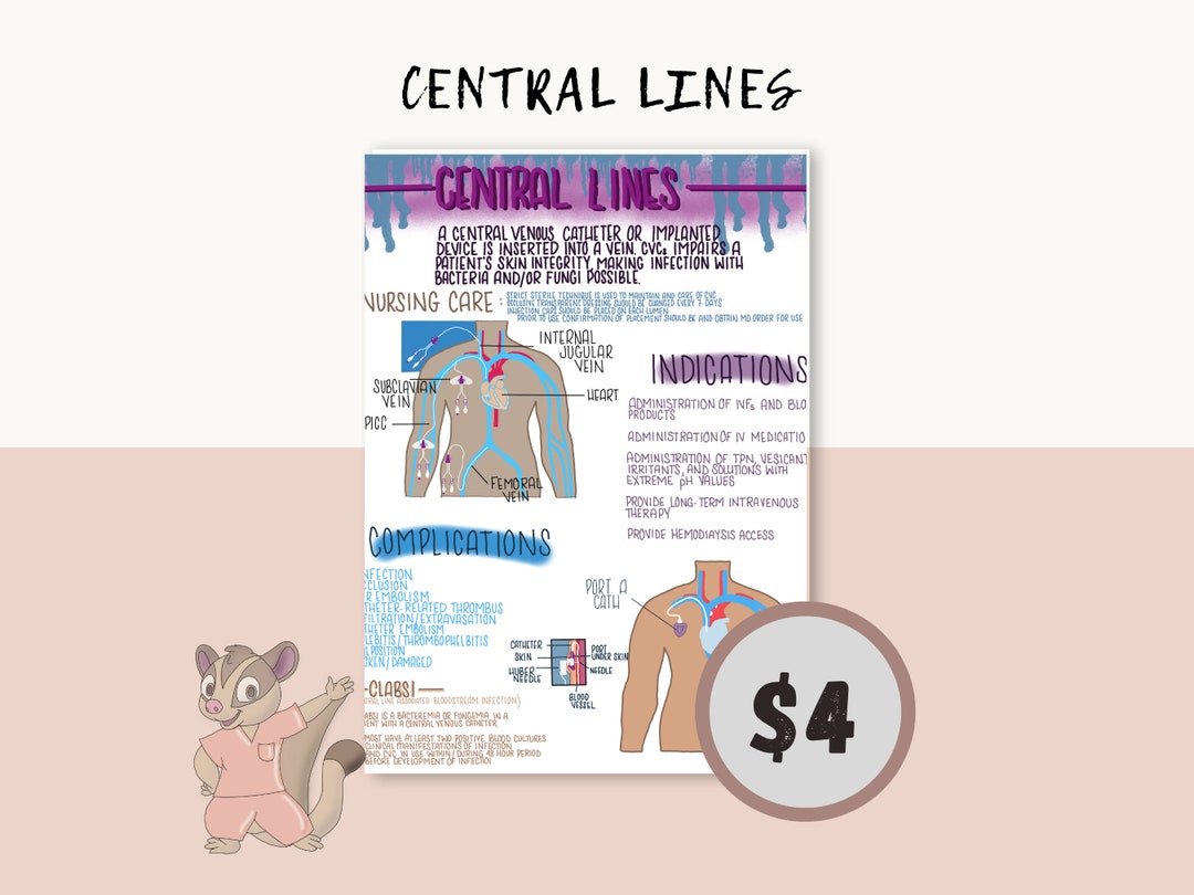 Central Lines - Etsy