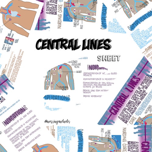 Central Lines - Etsy