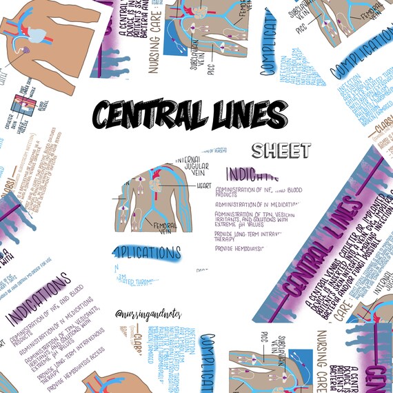 Central Lines | Etsy