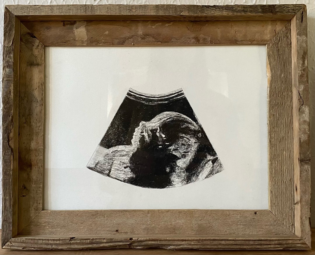 Nursery Art, Custom Ultrasound Charcoal Drawing, Baby Shower Gift ...