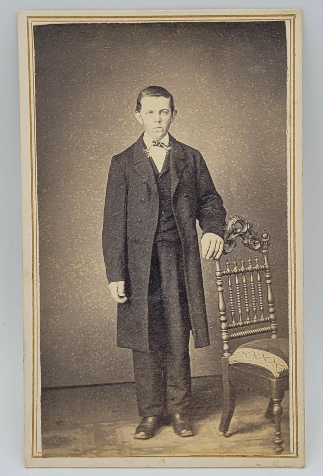 Young Man Hand on Chair~cdv Photo~austere Setting~wearing Longer Jacket ...
