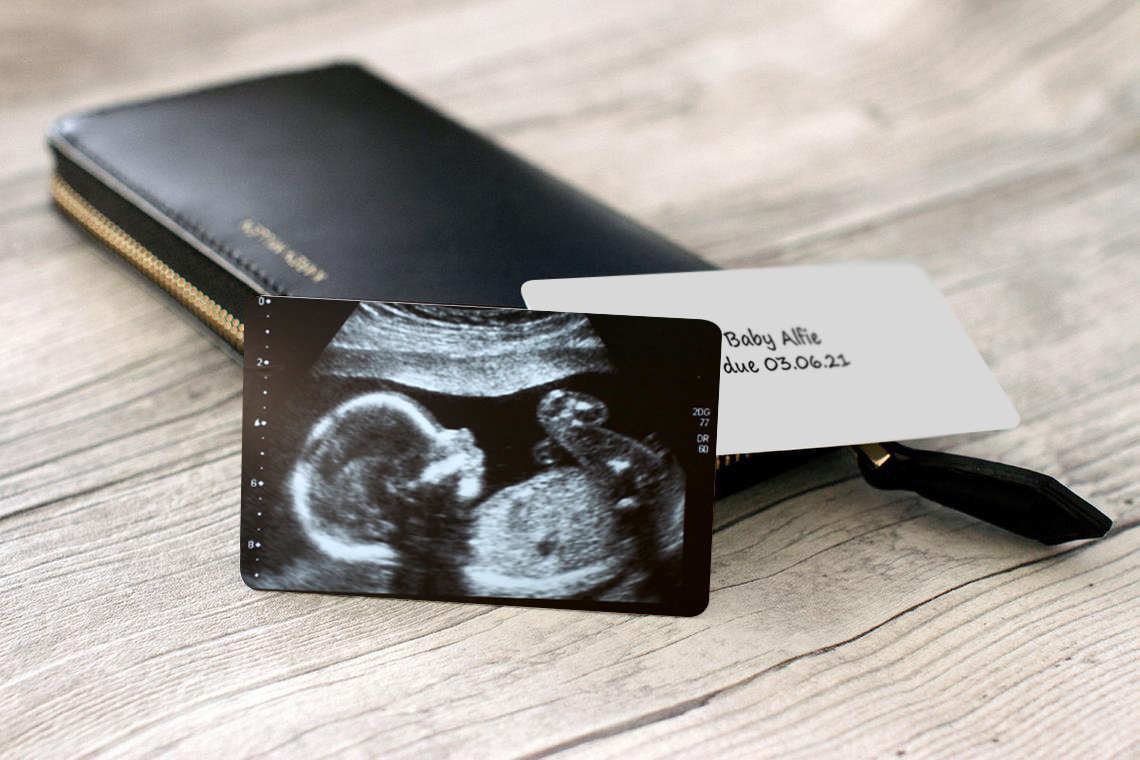 Personalised Baby Scan Photo & Message Plastic Card Keepsake - Etsy