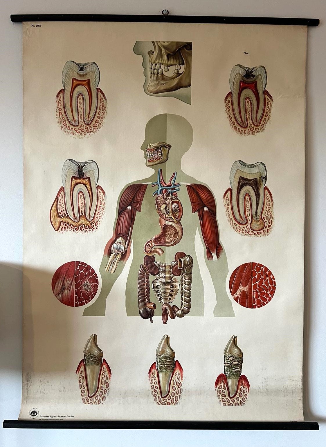 1945 Vintage School Chart - Medical Antique - Pull Down Chart ...