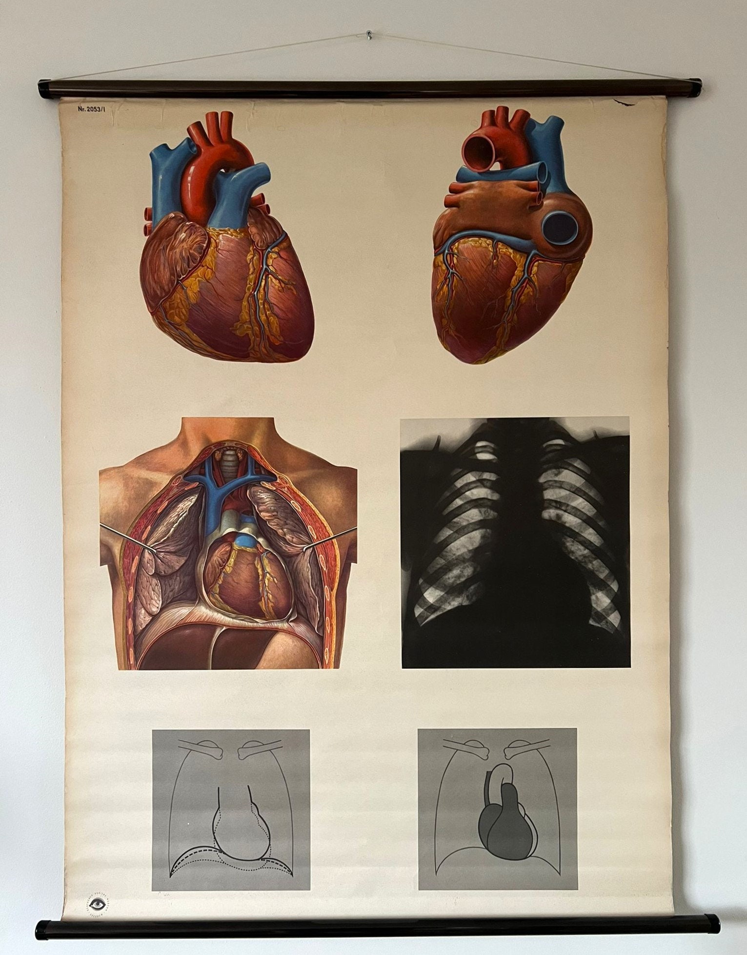 1940 - Pull Down Chart - Medical Antique - Medical Chart - Vintage ...