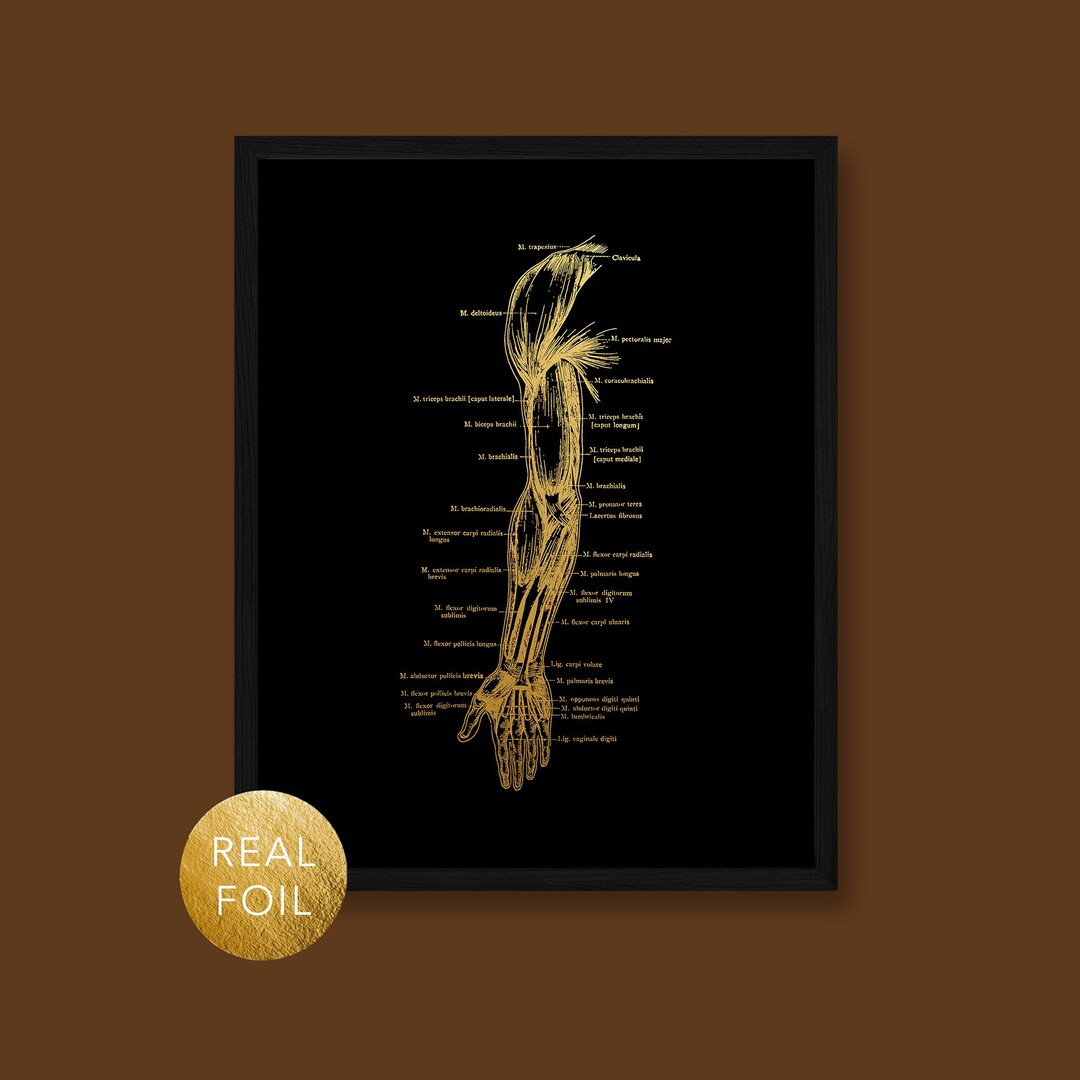 Gold Foil Arm Anatomy Print: Vintage Medical Diagram Wall Art - Etsy
