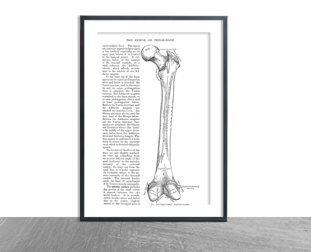 Anatomy Femur Thigh Bone Décor Anatomical Art Patent Prints,medical ...