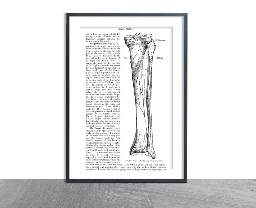 Anatomy the Tibia Antique Print Anatomy Décor Anatomical Art Patent ...