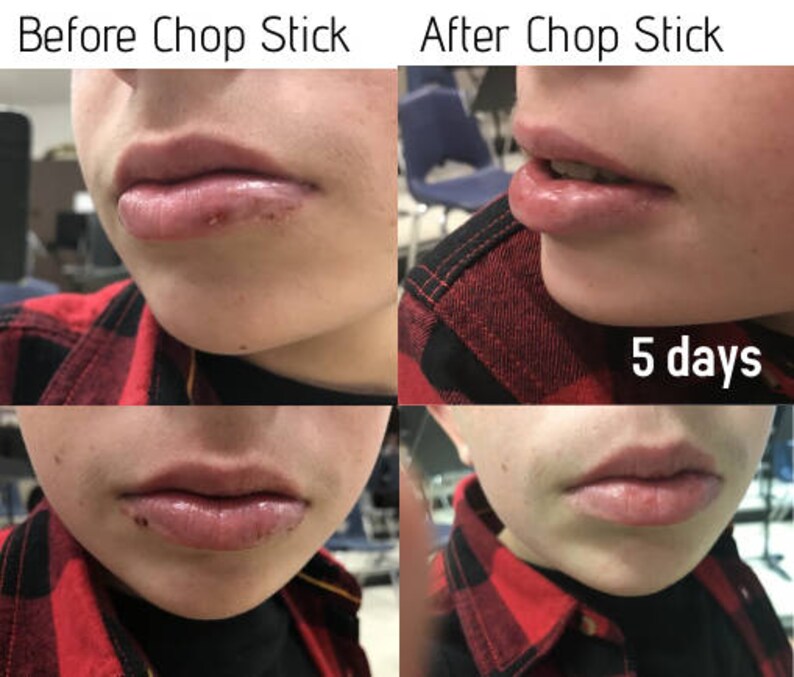 Lip Balm, Organic, Lips, Chapstick, Healing, Cracked, Essential Oil ...