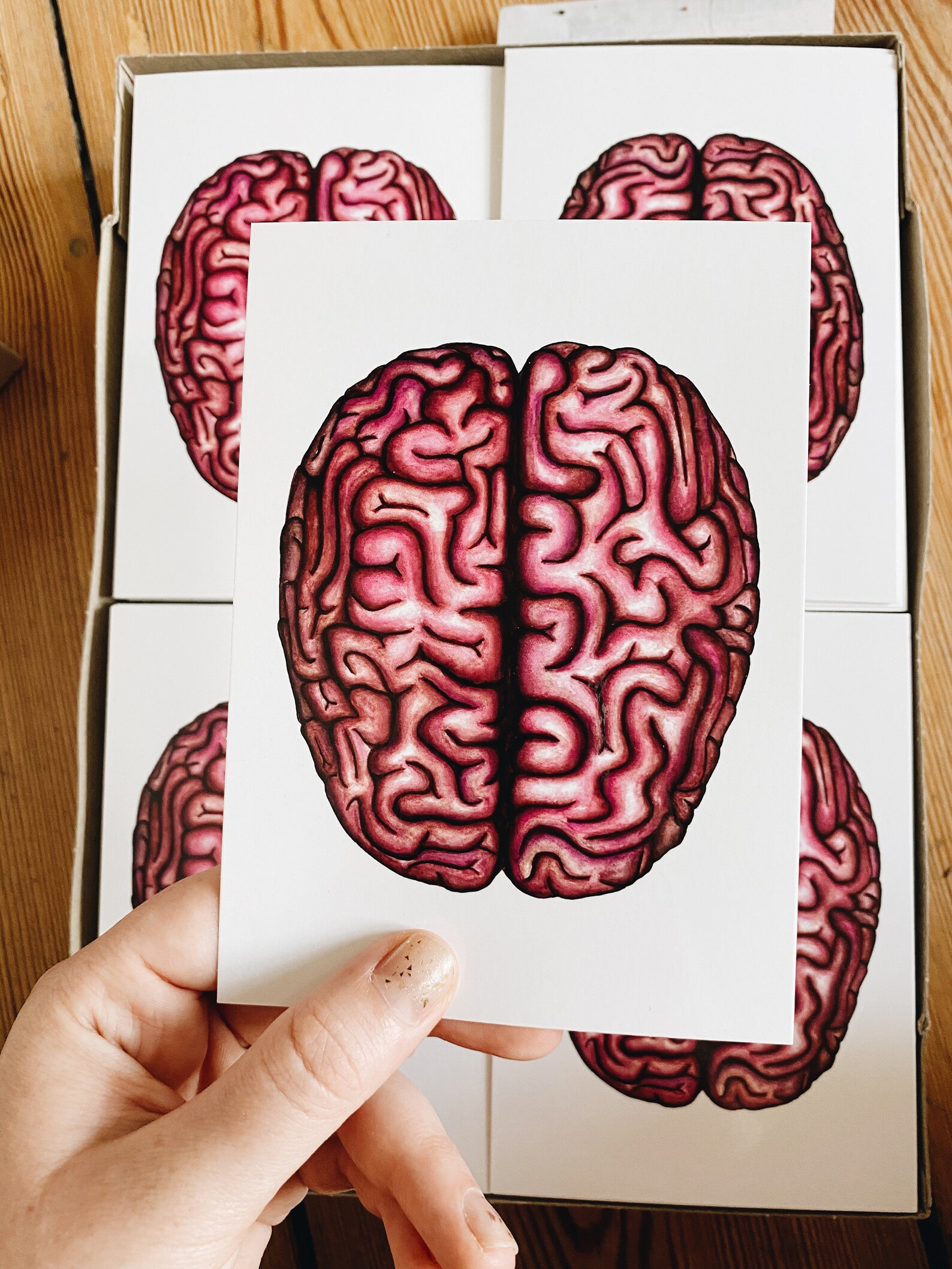 Brain Anatomy Postcard: Anatomical Card Unique Medical - Etsy