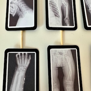 Xray Radiology Technician Skeleton Medical Imaging Bones Bone ...