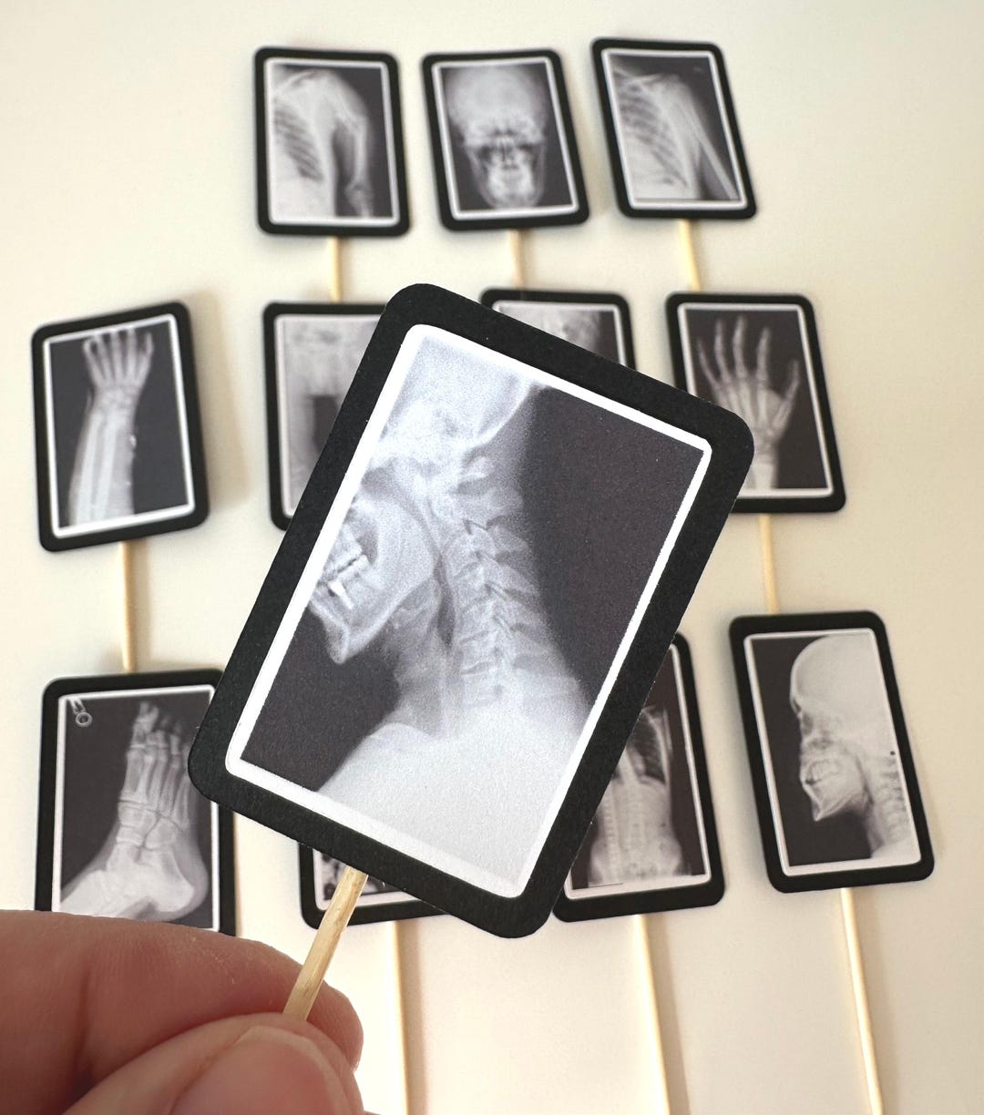 Xray Radiology Technician Skeleton Medical Imaging Bones Bone ...