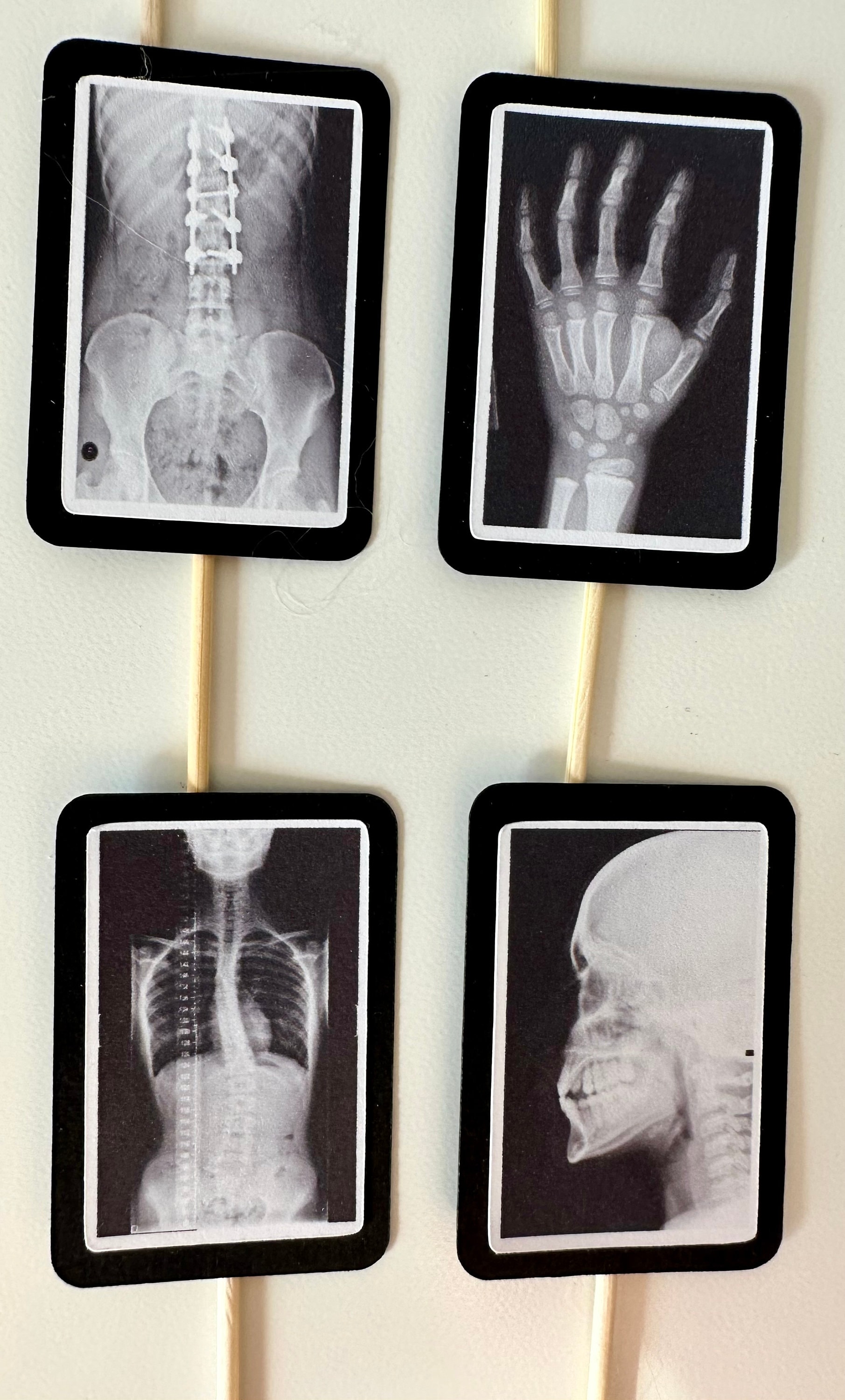 Xray Radiology Technician Skeleton Medical Imaging Bones Bone ...