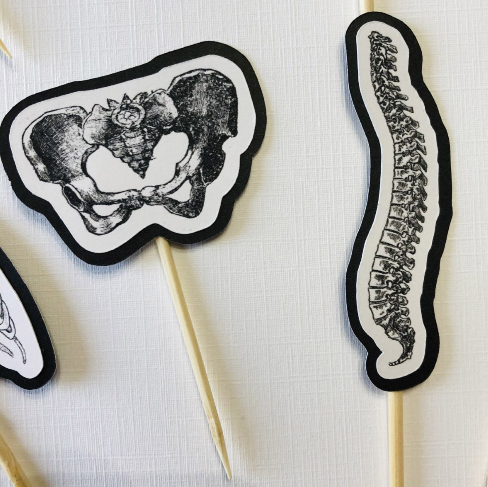 Xray Radiology Technician Skeleton Medical Imaging Bones Bone ...