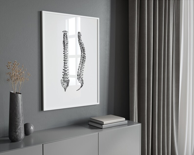 Spine Anatomy Poster, Vertebral Column Print, Spinal Anatomy Art ...