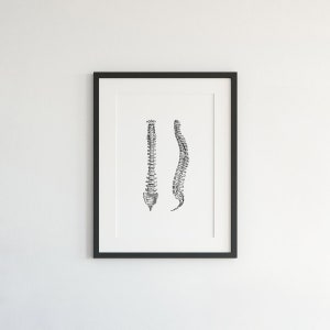 Spine Anatomy Poster, Vertebral Column Print, Spinal Anatomy Art ...