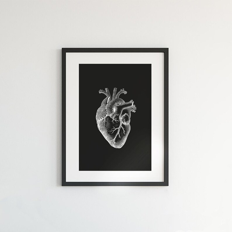Heart Anatomy Print, Black and White, Medical Wall Art, Cardiologist ...