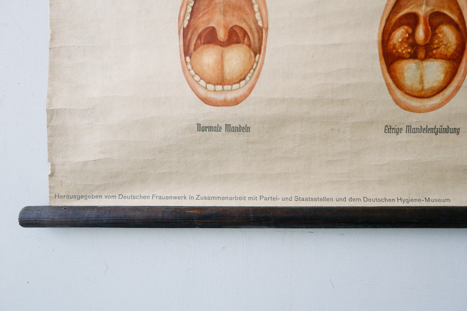 Original ANATOMICAL Vintage German School Wall Chart CHILDHOOD DISEASES ...