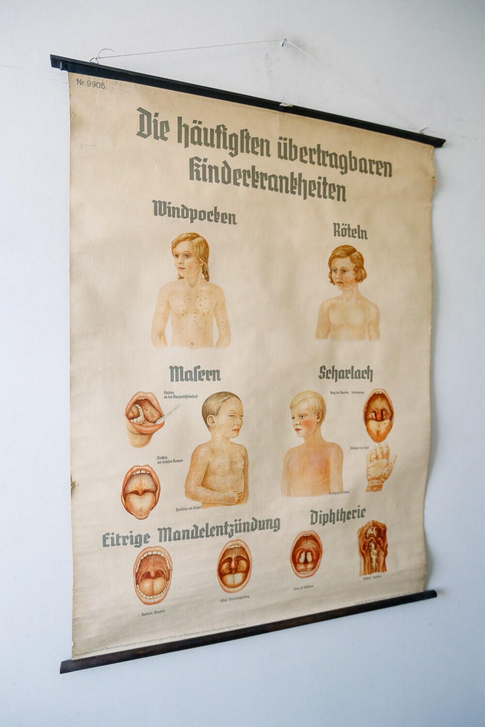 Original ANATOMICAL Vintage German School Wall Chart CHILDHOOD DISEASES ...