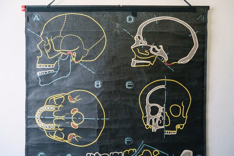Original ANATOMICAL Vintage Mid Century French School Chalk Wall Chart ...