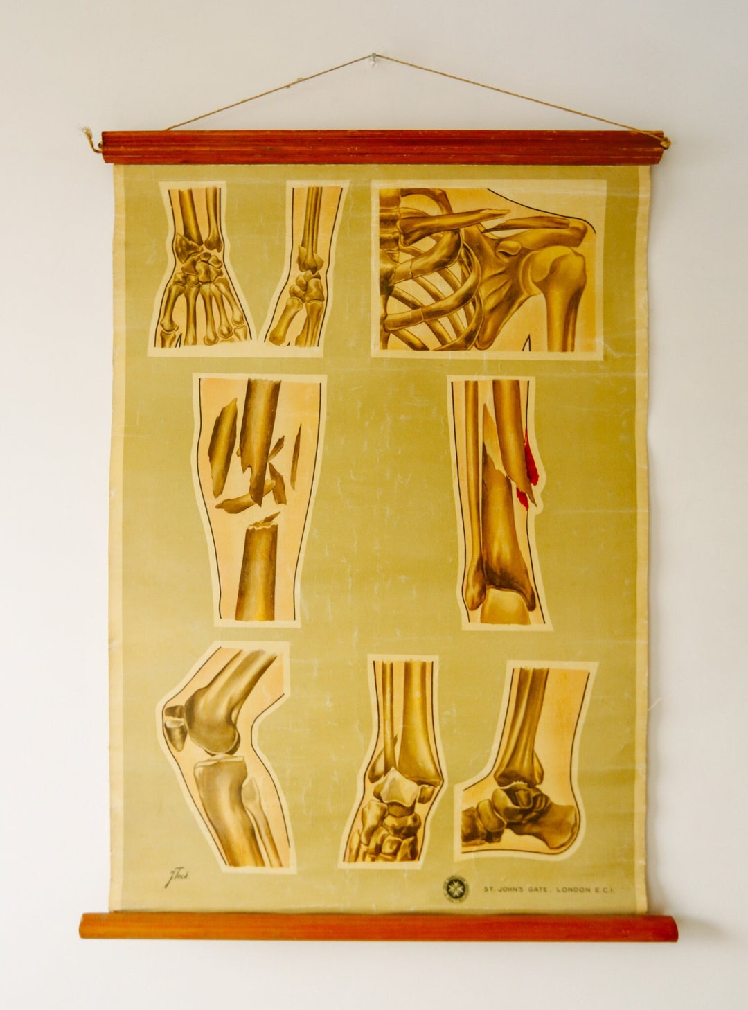 Original ANATOMICAL Vintage British Educational School Wall Chart BONE ...