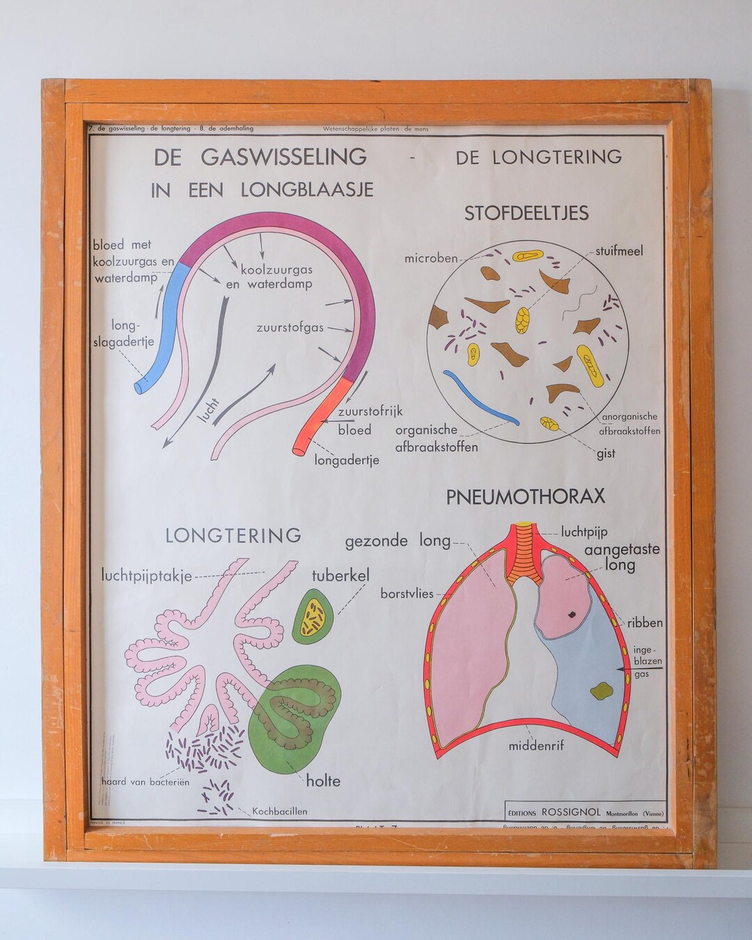 Original ANATOMICAL Vintage French School Print Human Anatomy ...