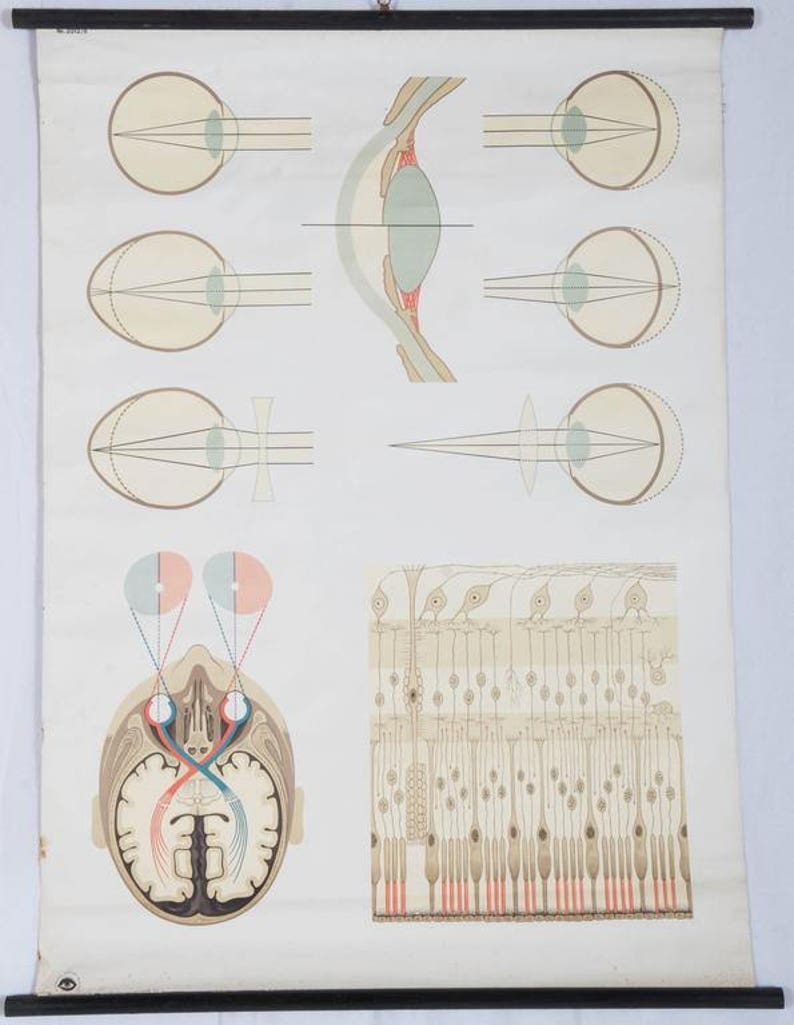 Vintage Large German Medical Chart, Poster "eye Ii" - Etsy
