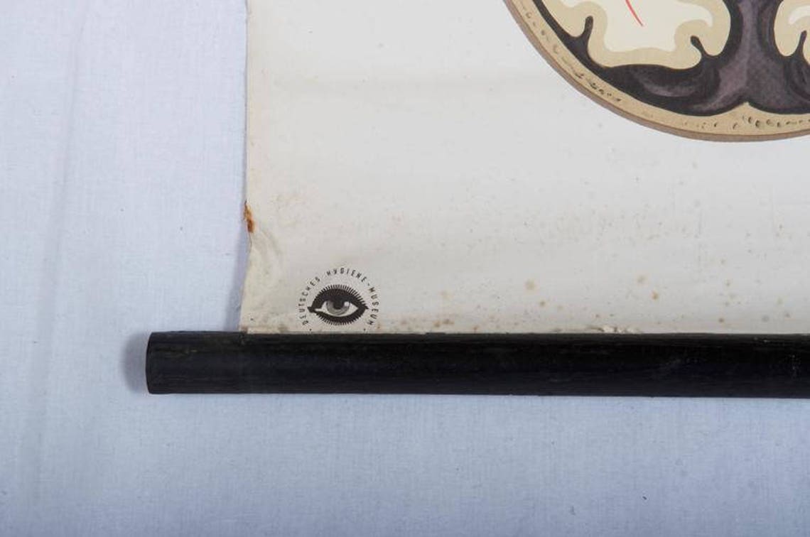 Vintage Large German Medical Chart, Poster "eye Ii" - Etsy