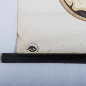 Vintage Large German Medical Chart, Poster "eye Ii" - Etsy
