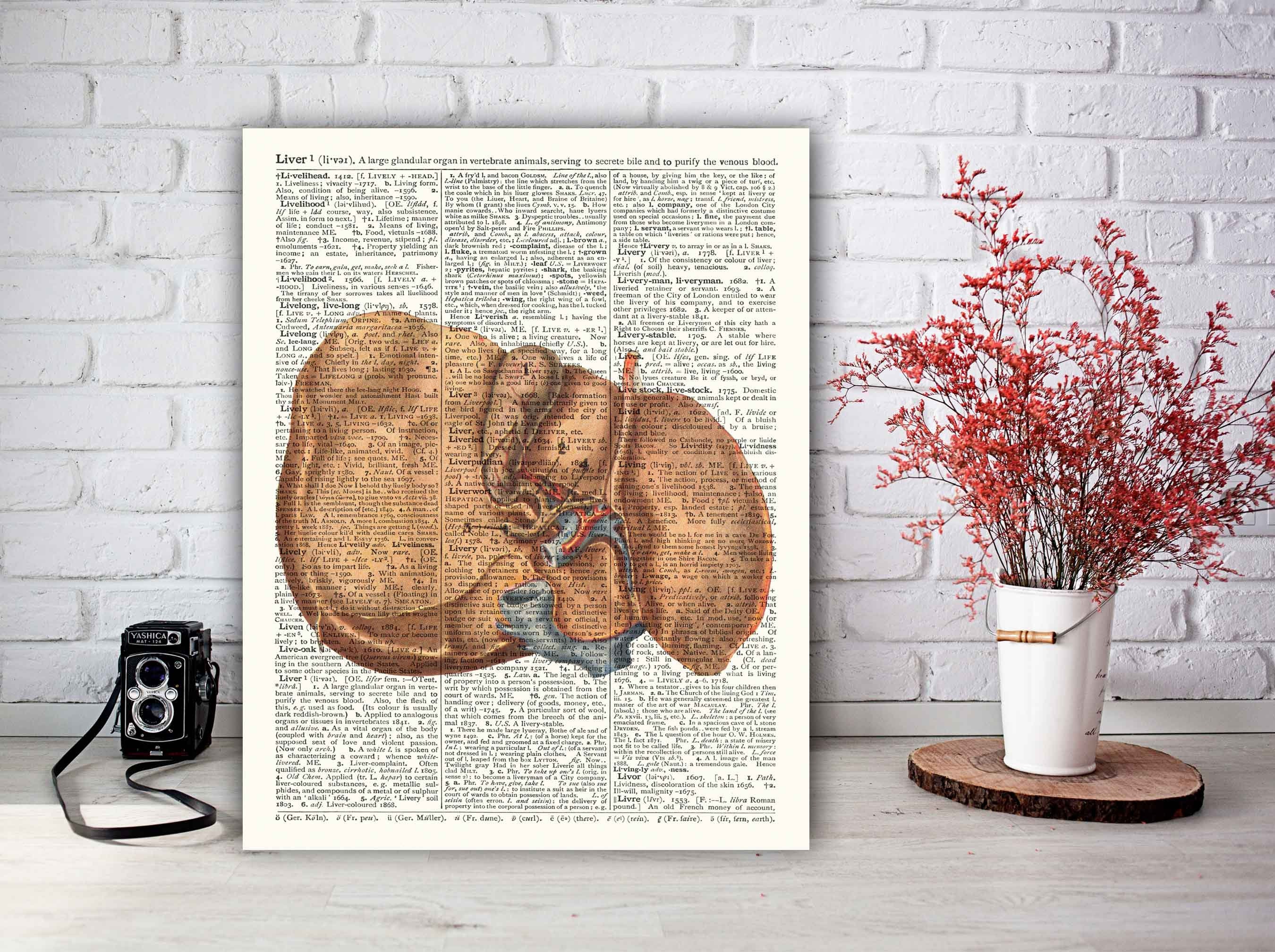 Liver Anatomy Art Print Human Liver Wall Art Hepatologist | Etsy
