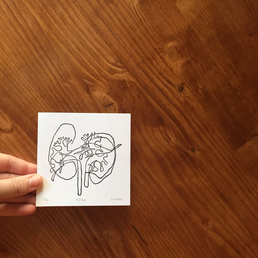 Kidneys Print, Tiny Artwork, Lino Print, Anatomy Art, Biology Art ...