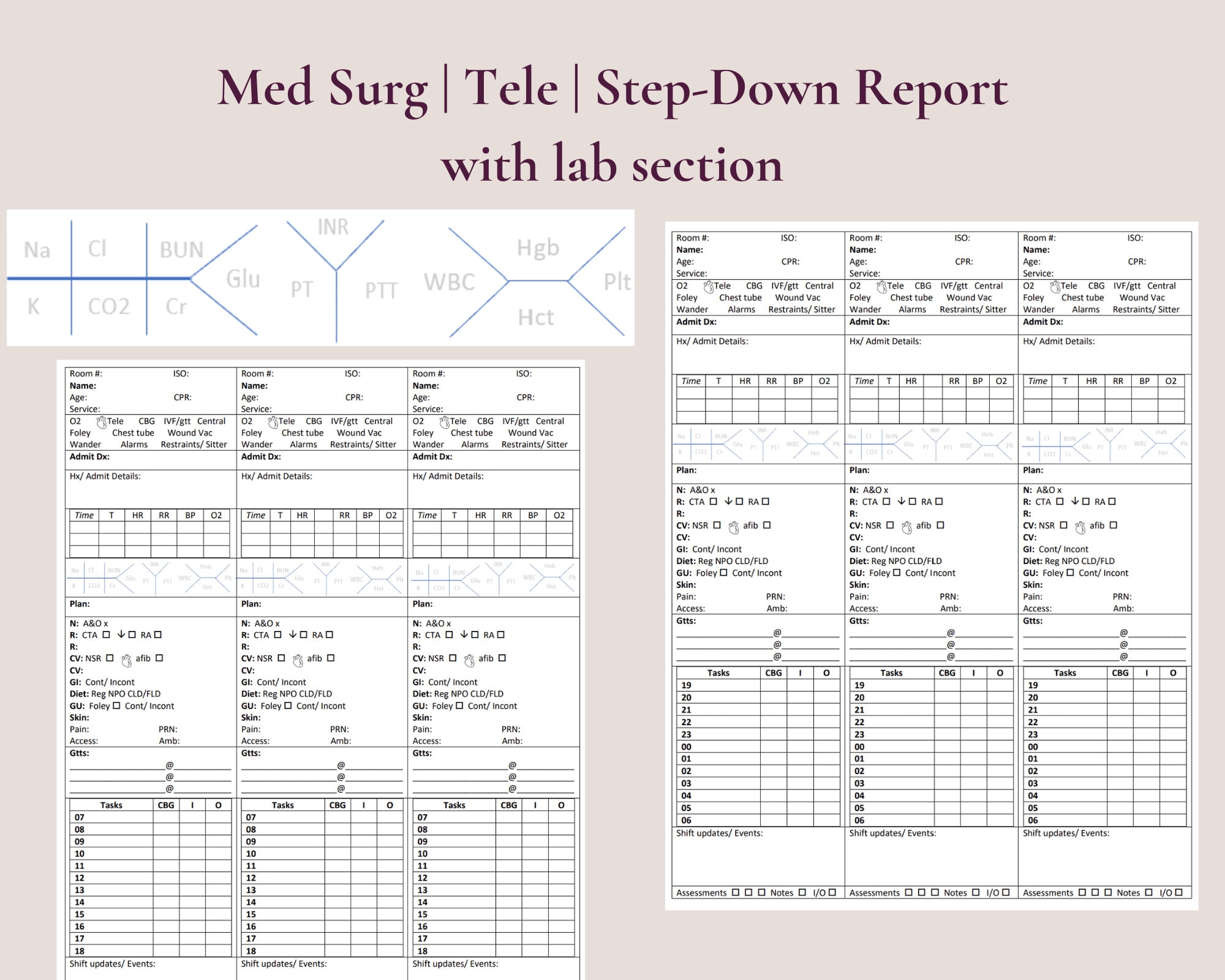 Editable Med Surg or Step Down Nurse Report Sheet for 3 Patients - Etsy