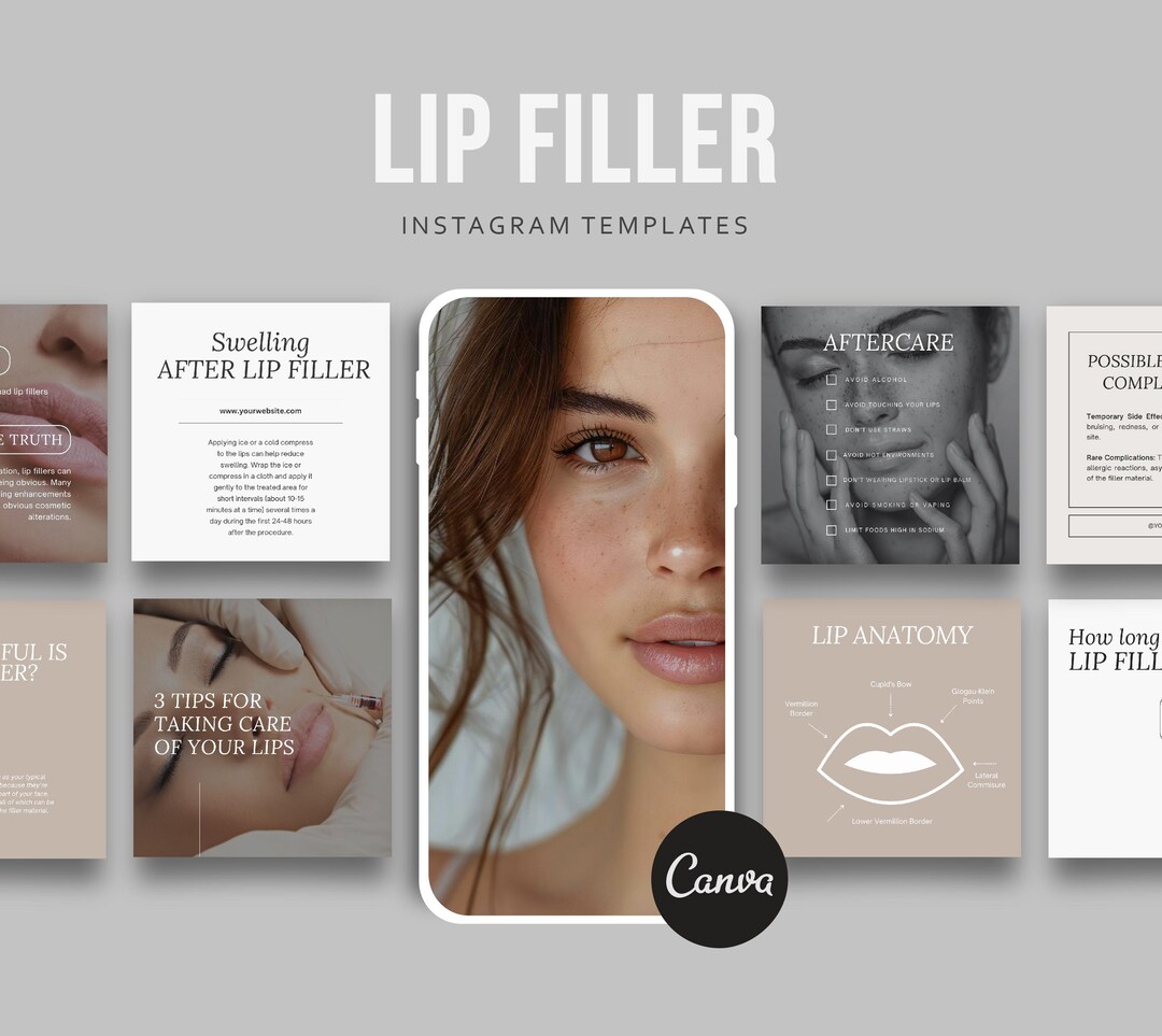 100 Medspa Templates | Lip Filler Templates | Injector Instagram ...