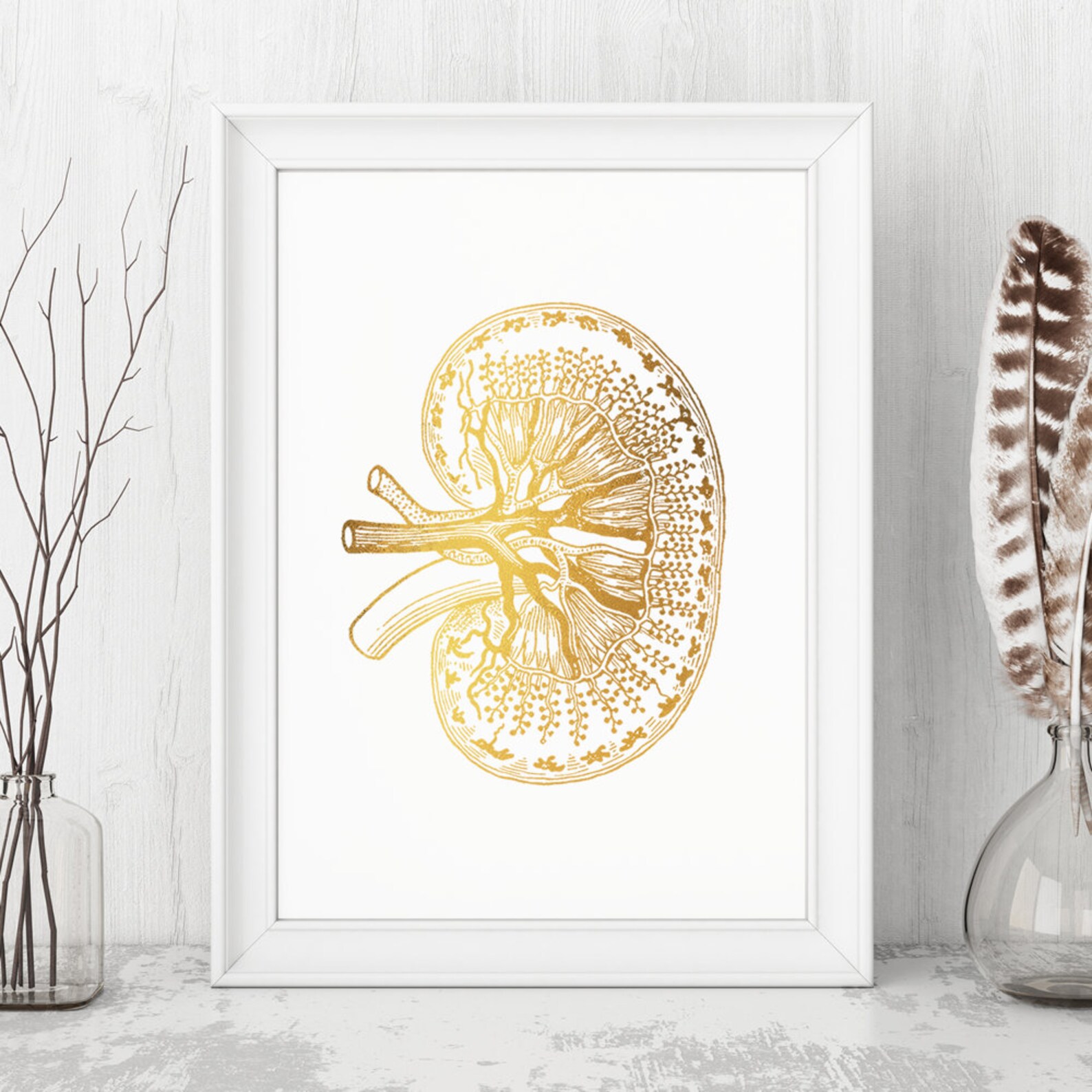 Human Kidney Anatomy Art Doctor Office Decor Nephrology - Etsy