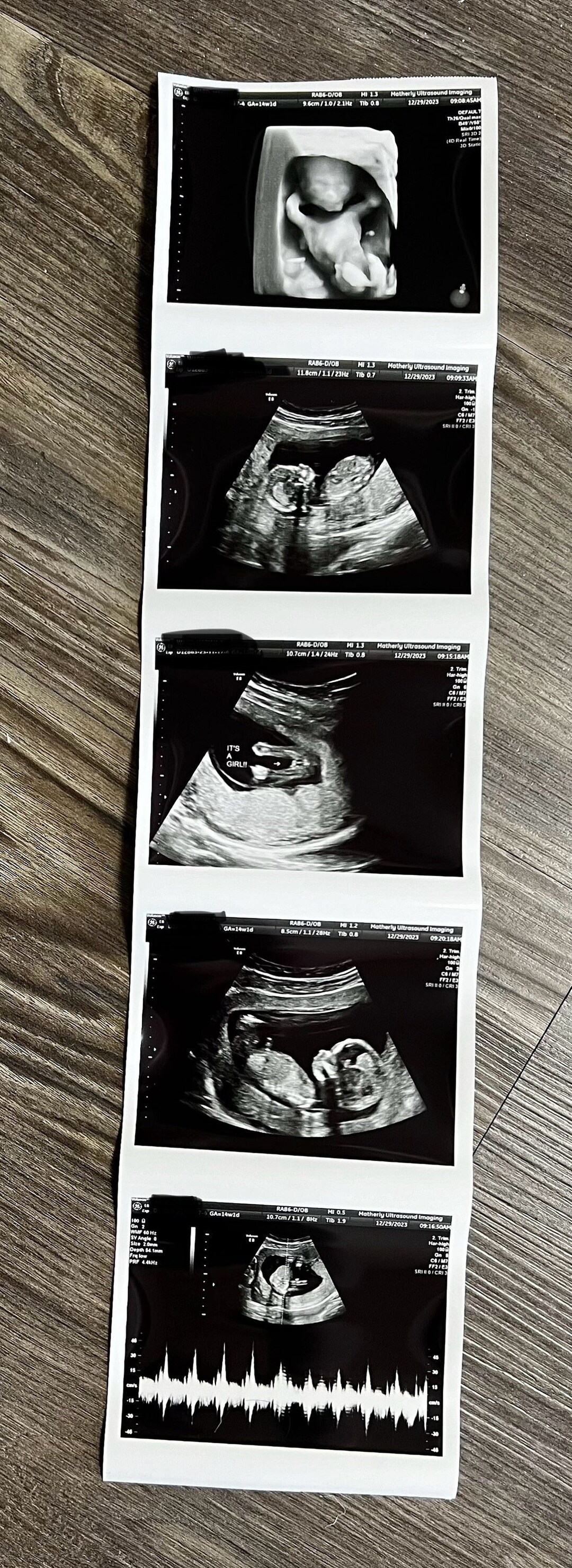 Custom Printed Ultrasound Strip - Etsy