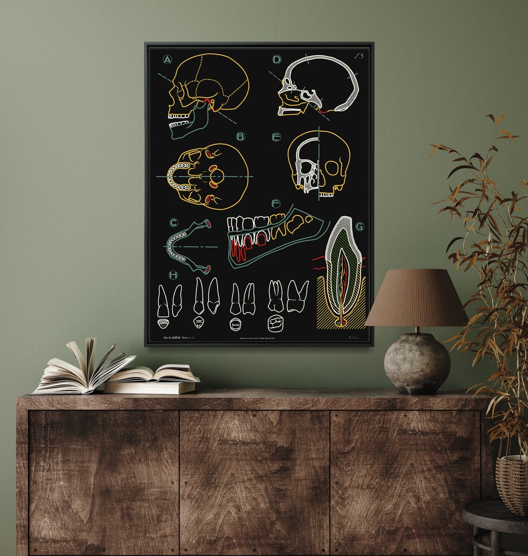 Human Skull & Teeth Vintage Chart Print Anatomical Poster Medical Wall ...