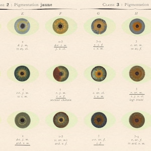 Eye Colour Vintage Chart Print, Vision & Optometry Poster ...