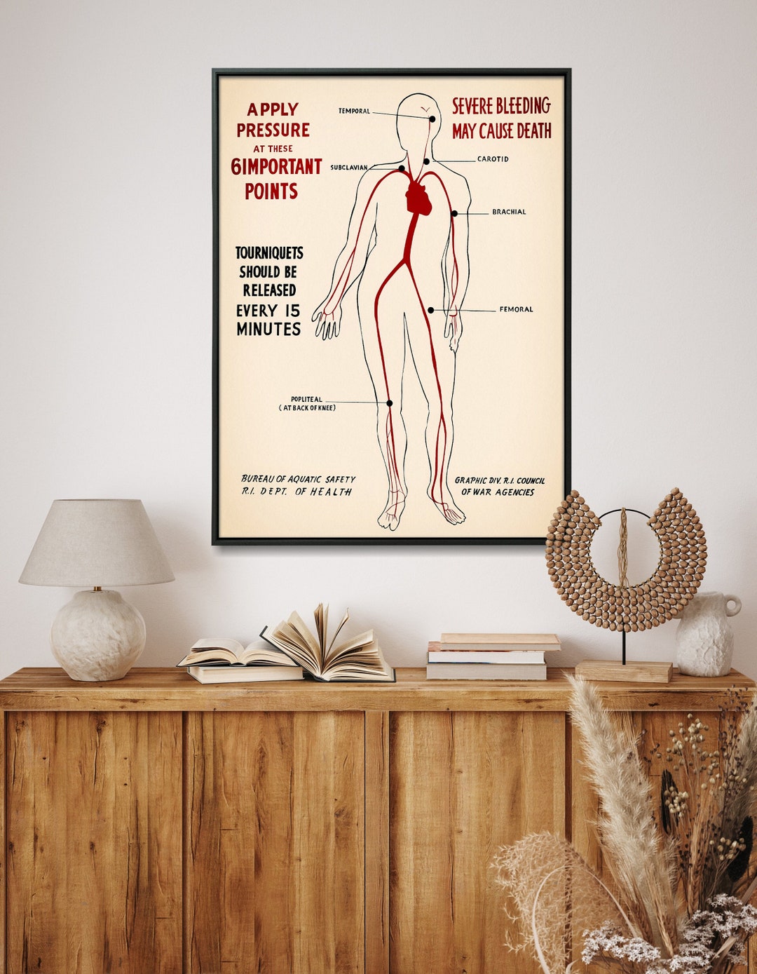 First Aid: Stop Bleeding Points WW2 Vintage Chart Print, Doctor's ...
