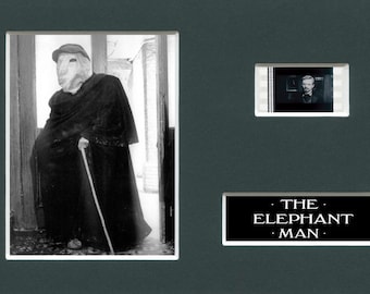 Joseph Merrick, the Elephant Man Life-size Skull Reproduction - Etsy