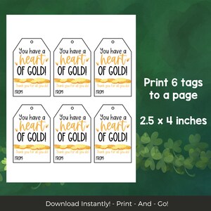 You Have a Heart of Gold St Patricks Day Printable Gift Tag, St ...