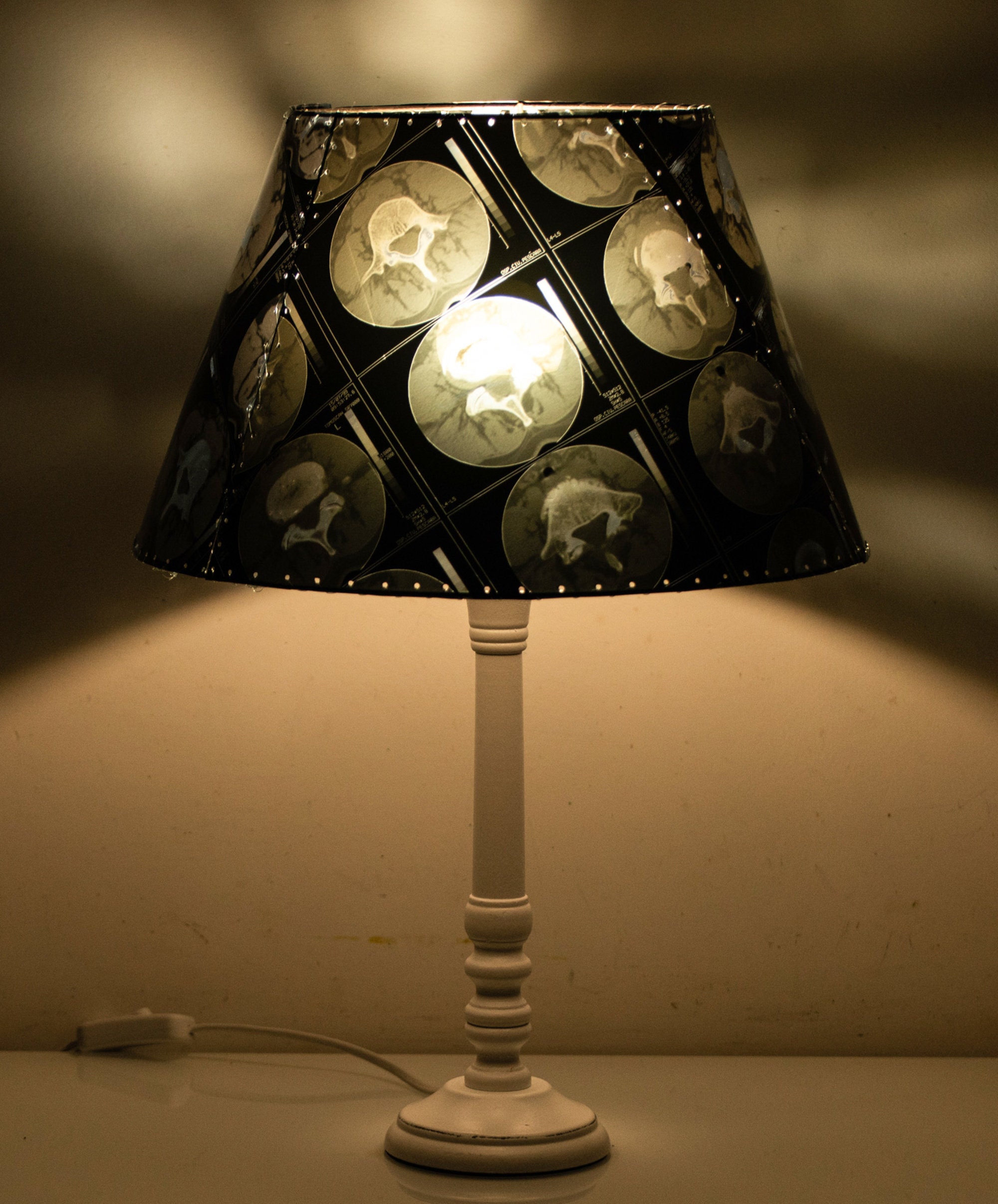 Table Lamp X Ray Rmi Tc Spine Radiography Doctor Etsy